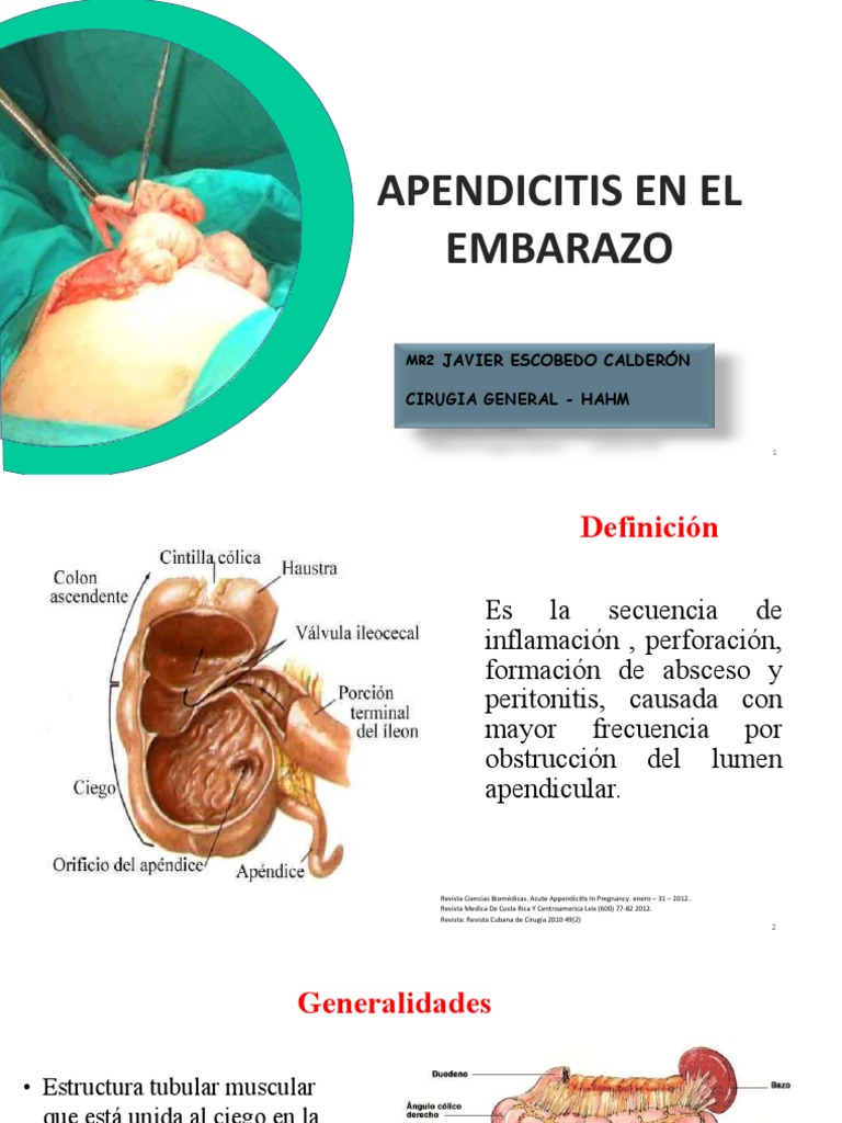Apendicitis en el Embarazo: Síntomas y Tratamiento | PDF ...