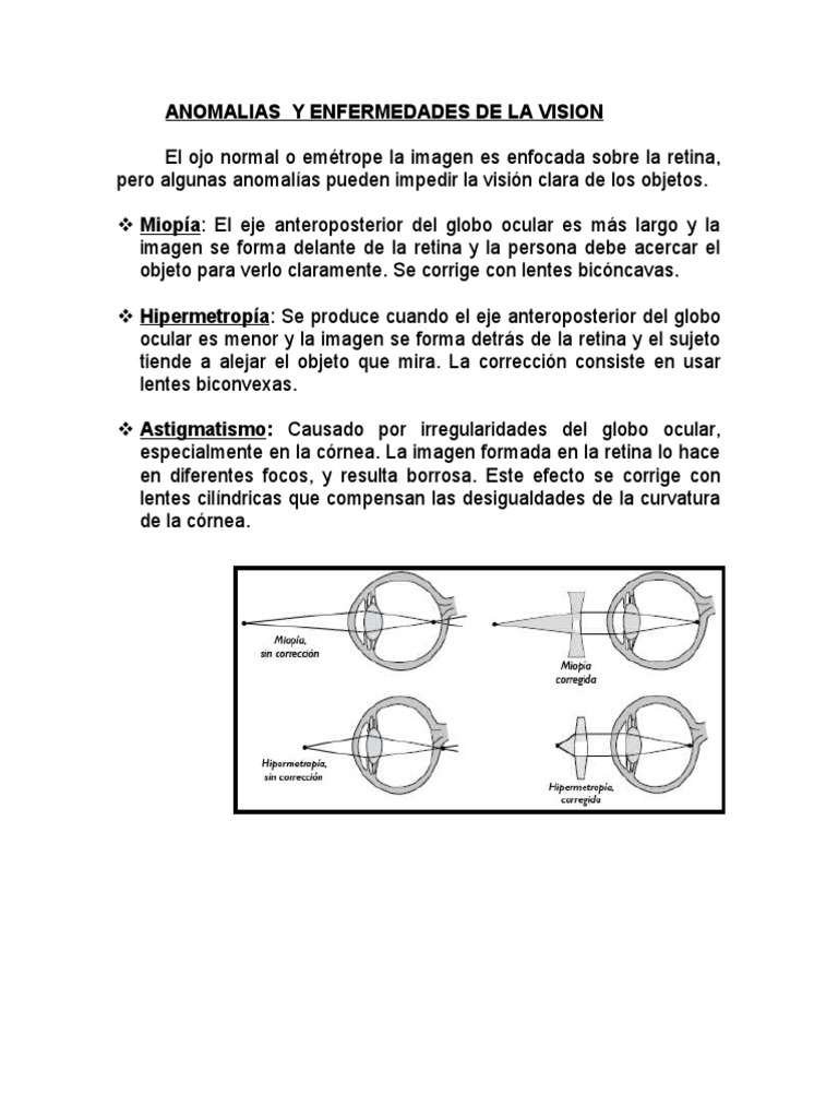 Anomalias y Enfermedades de La Vision | PDF | Ojo humano | Enfermedades ...