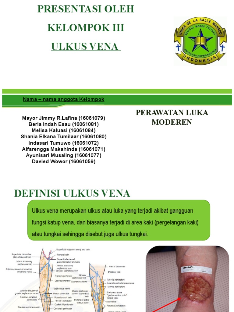 Ulkus Vena Presentasi | PDF