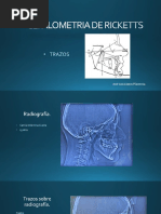 Perfiles Labiales y Línea S | PDF