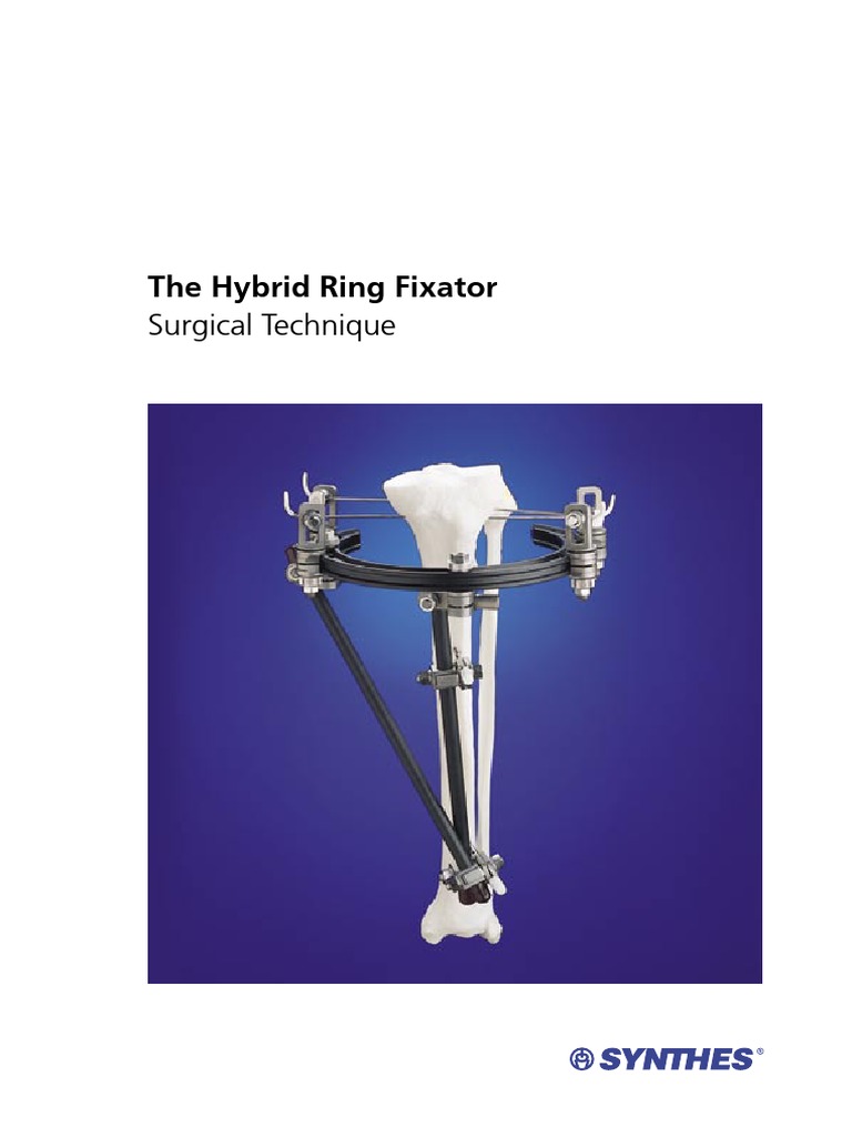The Hybrid Ring Fixator: Surgical Technique | PDF | Nut (Hardware) | Knee