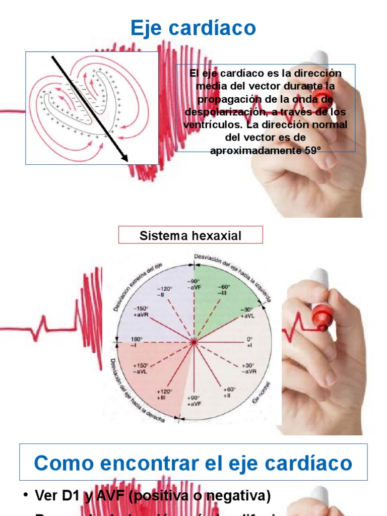Análisis del eje cardíaco y sus componentes en el electrocardiograma ...