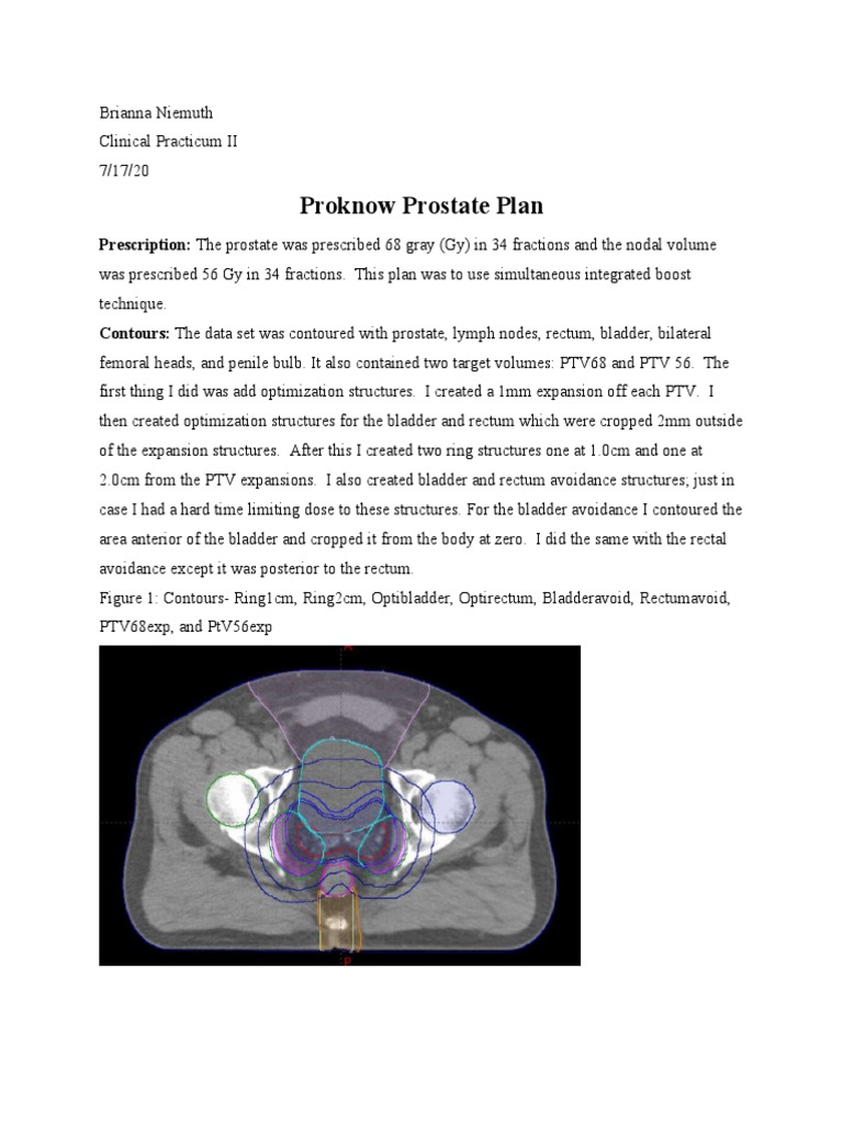 Proknow Prostate | PDF | Rectum | Radiation Therapy