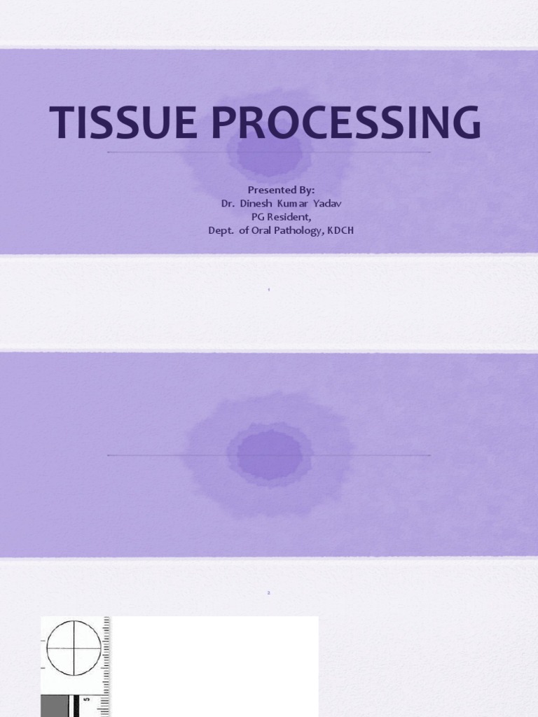 Tissue Processing: Dr. Dinesh Kumar Yadav PG Resident, Dept. of Oral ...