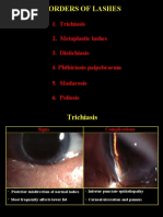 Understanding Trichiasis: Causes and Treatments | PDF | Pain | Surgery