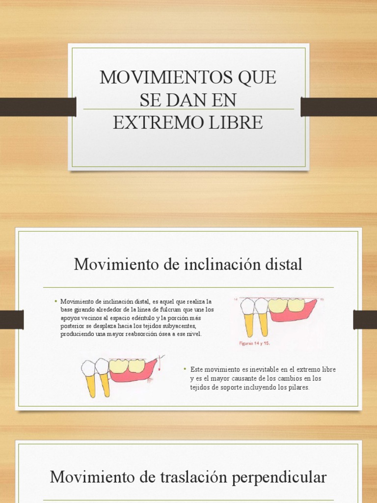 Movimientos en Extremo Libre de Prótesis | PDF | Dentadura postiza ...