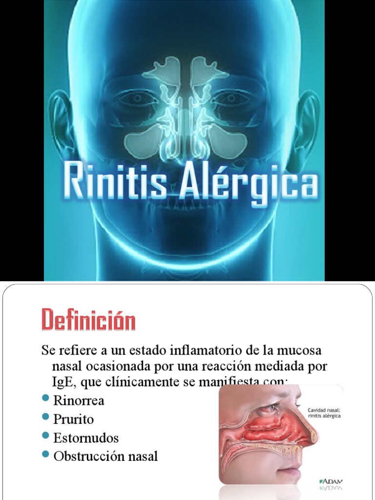 Rinitis Alérgica | PDF | Alergia | Asma