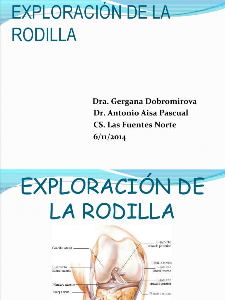 Exploración completa de la rodilla: aspectos clínicos y pruebas físicas ...