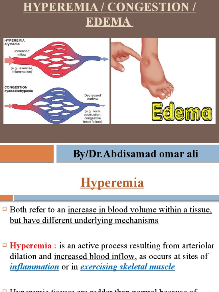 By/Dr - Abdisamad Omar Ali | PDF | Edema | Capillary