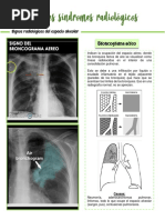 Guía de Signos Radiológicos de Tórax | PDF | Pulmón | Neumonía