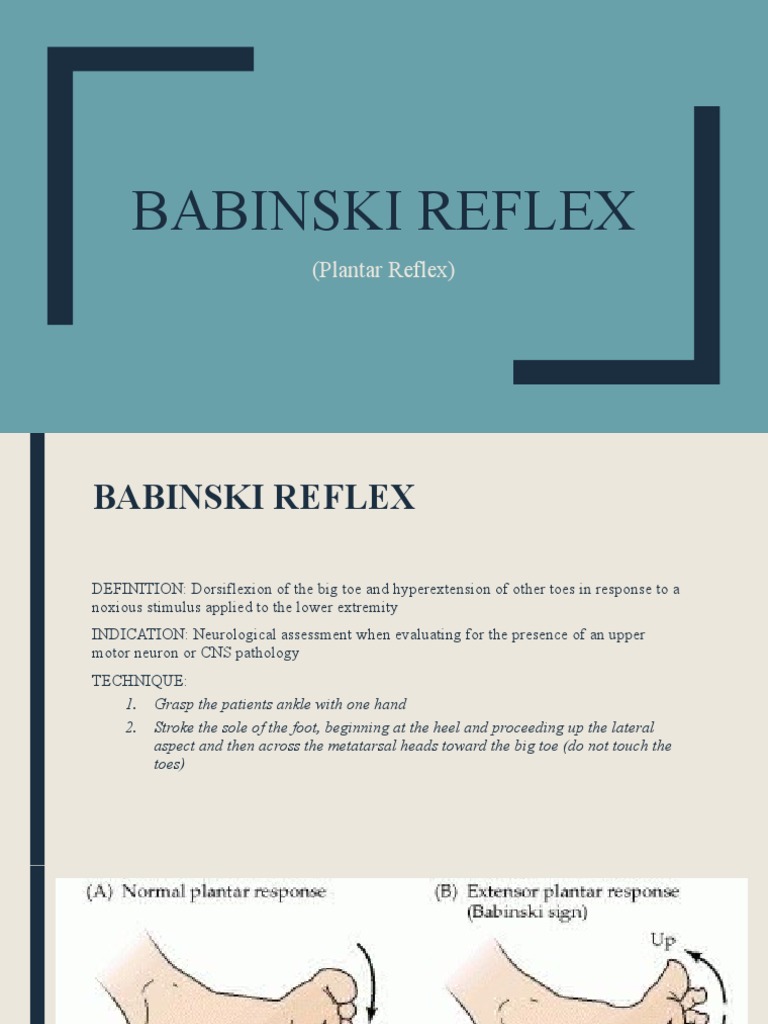 Babinski Reflex | PDF | Self-Improvement | Wellness