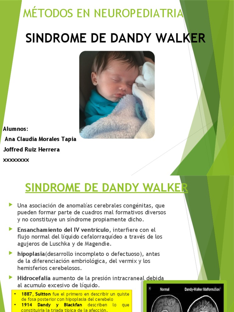 Síndrome de Dandy-Walker: Características, diagnóstico y tratamiento | PDF | Enfermedades y ...