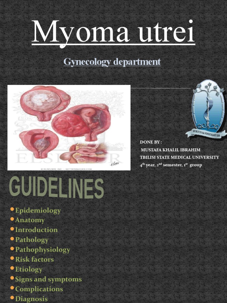 Myoma | PDF | Benign Tumor | Uterus