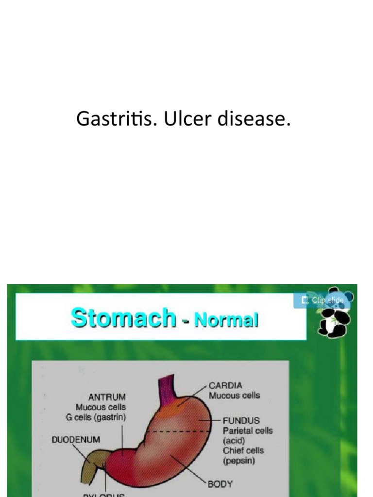 Gastritis. Ulcer Disease | PDF | Stomach | Gastroenterology