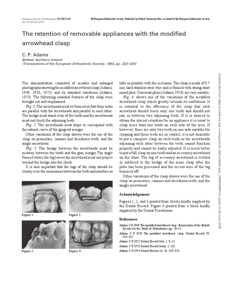 The Retention of Removable Appliances With The Modifi Ed Arrowhead ...