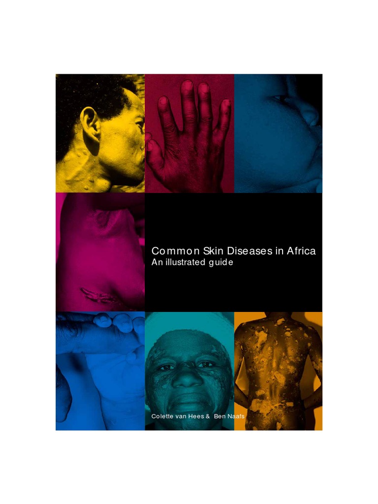 Common Skin Diseases in Africa: An Illustrated Guide | PDF | Dermatitis ...