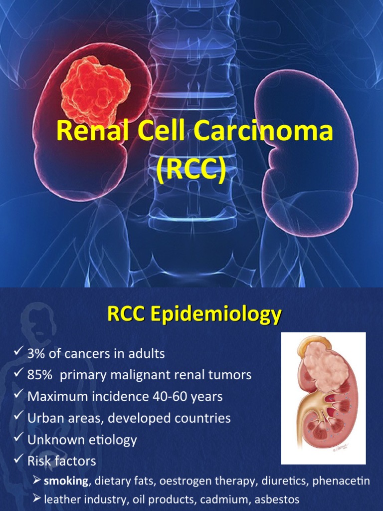 Urology Lecture No. 4 - Urological Cancers | PDF | Metastasis | Carcinoma