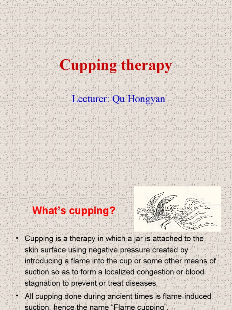 Cupping Therapy: Lecturer: Qu Hongyan | PDF | Edema | Clinical Medicine