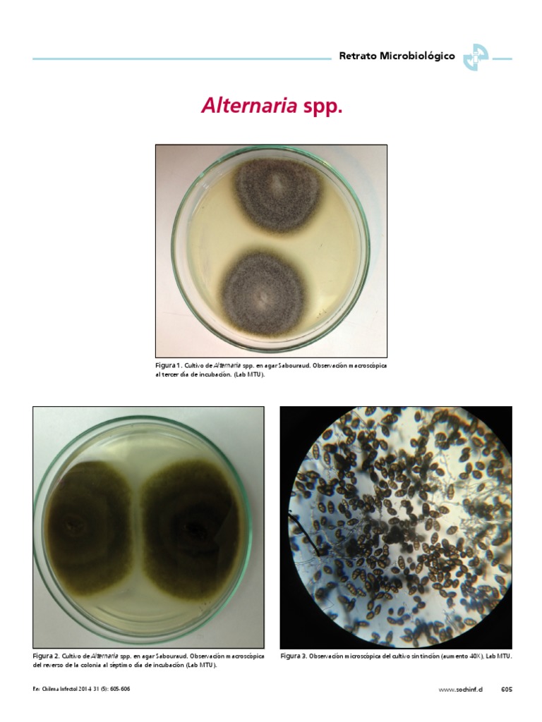 Observación de Alternaria spp. al microscopio | PDF | Hongo | Biología