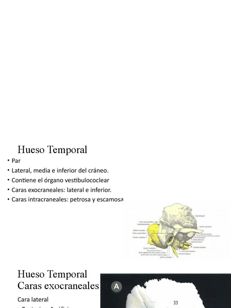 Estructura del Hueso Temporal | PDF | Cabeza y cuello humanos ...