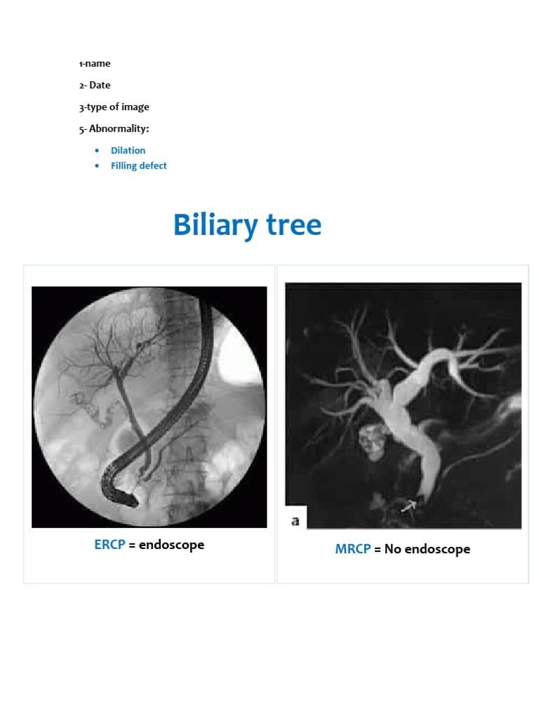 Biliary Tree: 1-Name 2-Date 3-Type of Image 5 - Abnormality | PDF | Art
