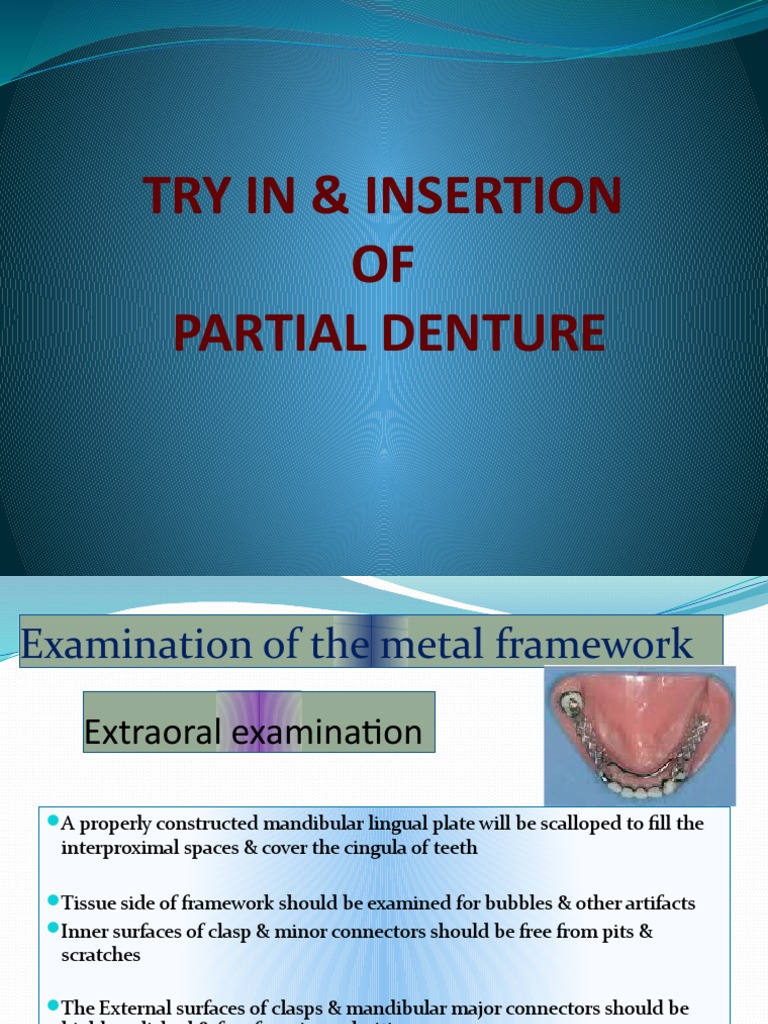 Try in &insertion | PDF | Dentures | Dentistry Branches