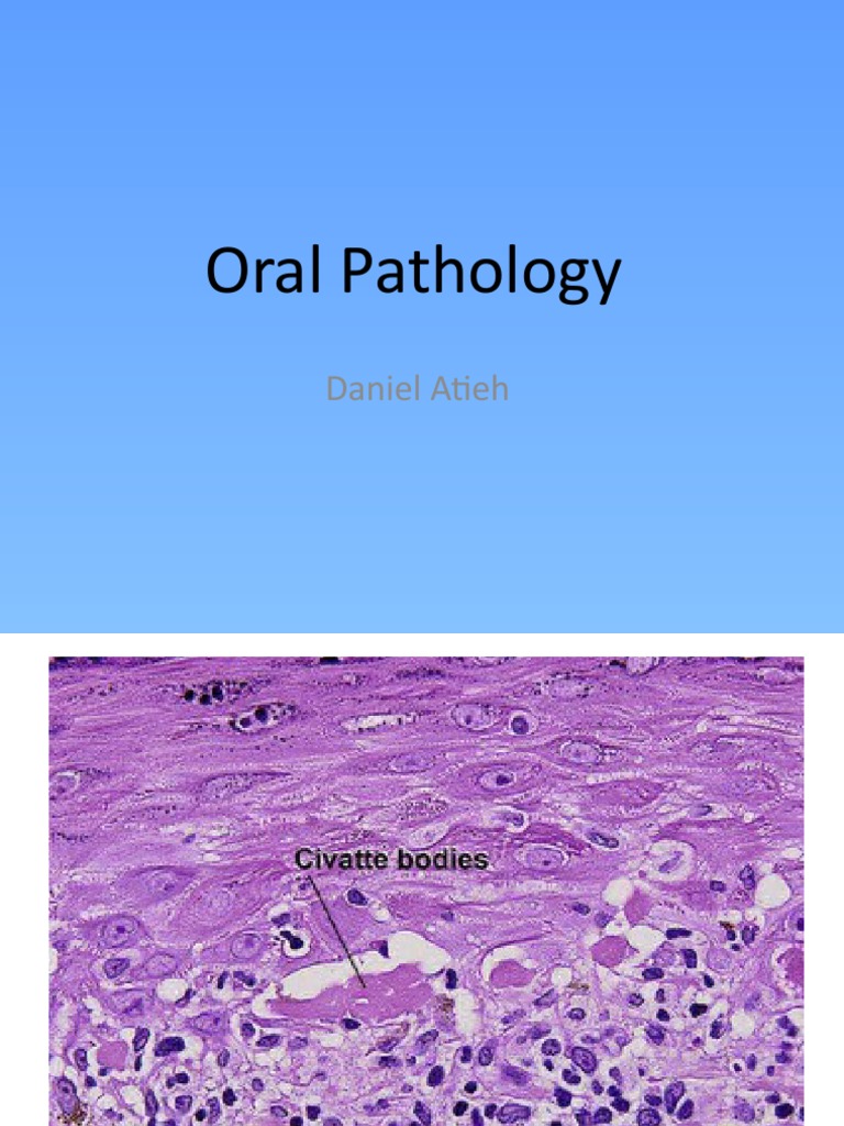 Oral Pathology Notes | PDF | Clinical Medicine | Diseases And Disorders