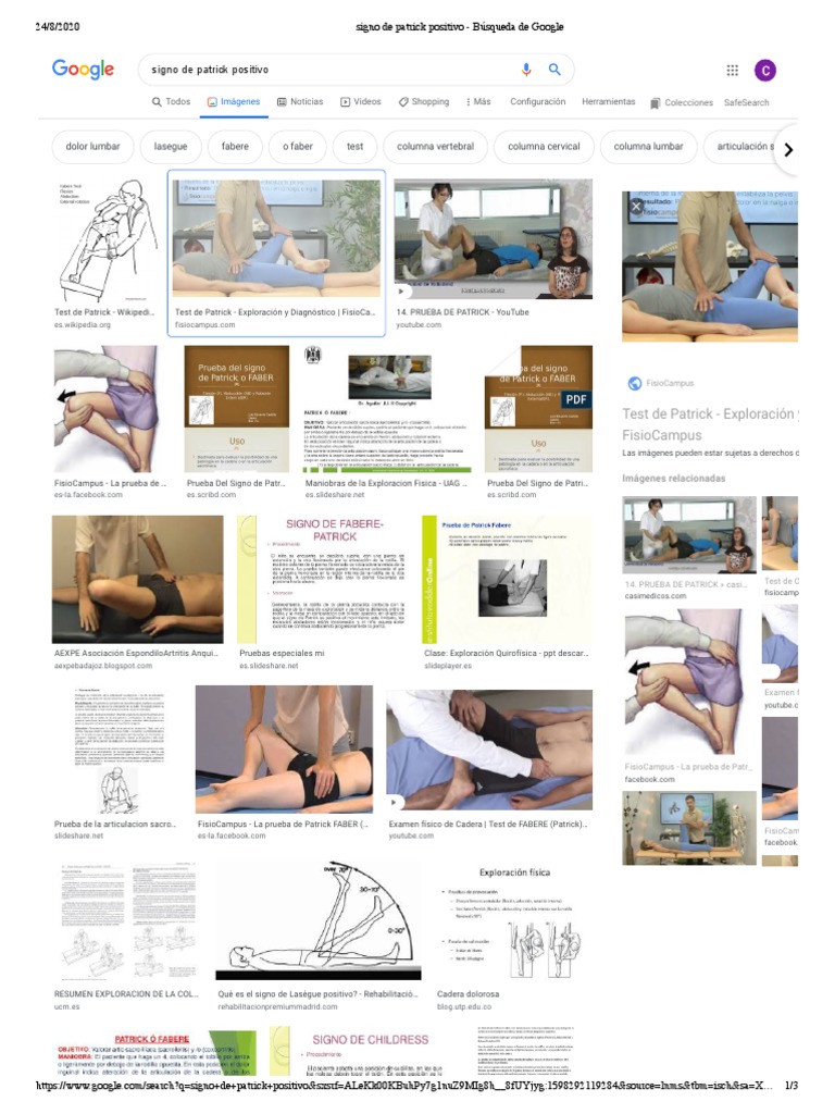 Signo de Patrick Positivo | PDF | Sistema musculoesquelético ...