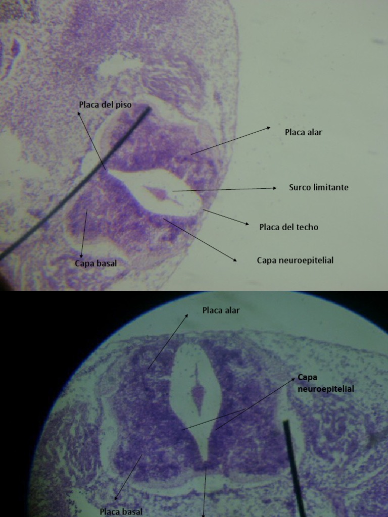 1 Neuroembriologia | PDF