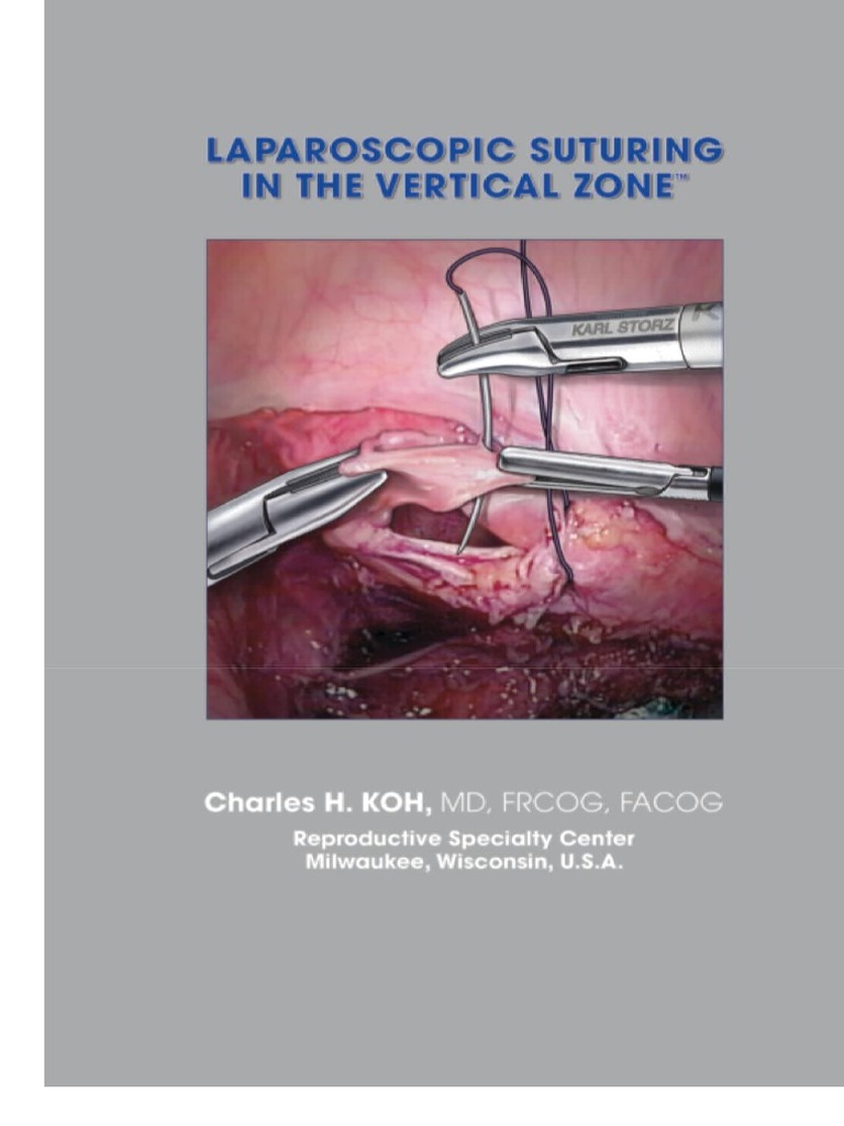 Laparoscopic Suturing in The Vertical Zone | PDF | Surgical Suture ...