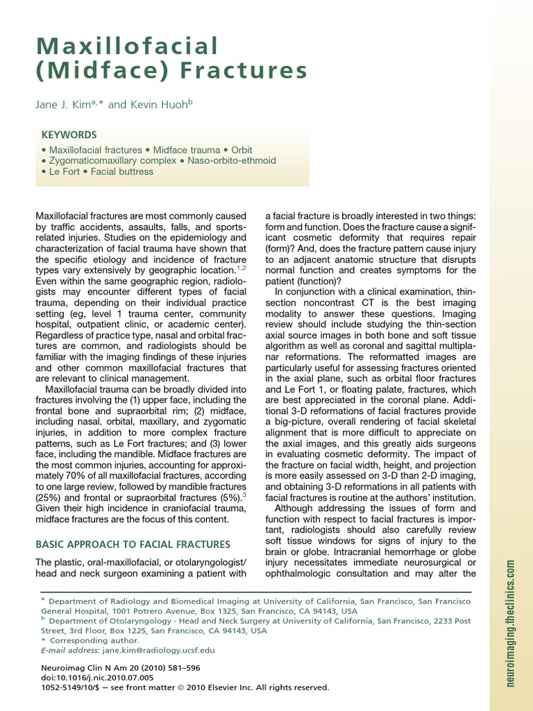 Maxillofacial (Midface) Fractures | PDF | Human Nose | Human Head And Neck