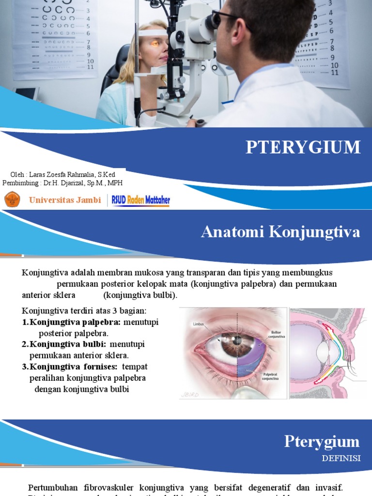 Pterygium - Revisi | PDF | Sains & Matematika