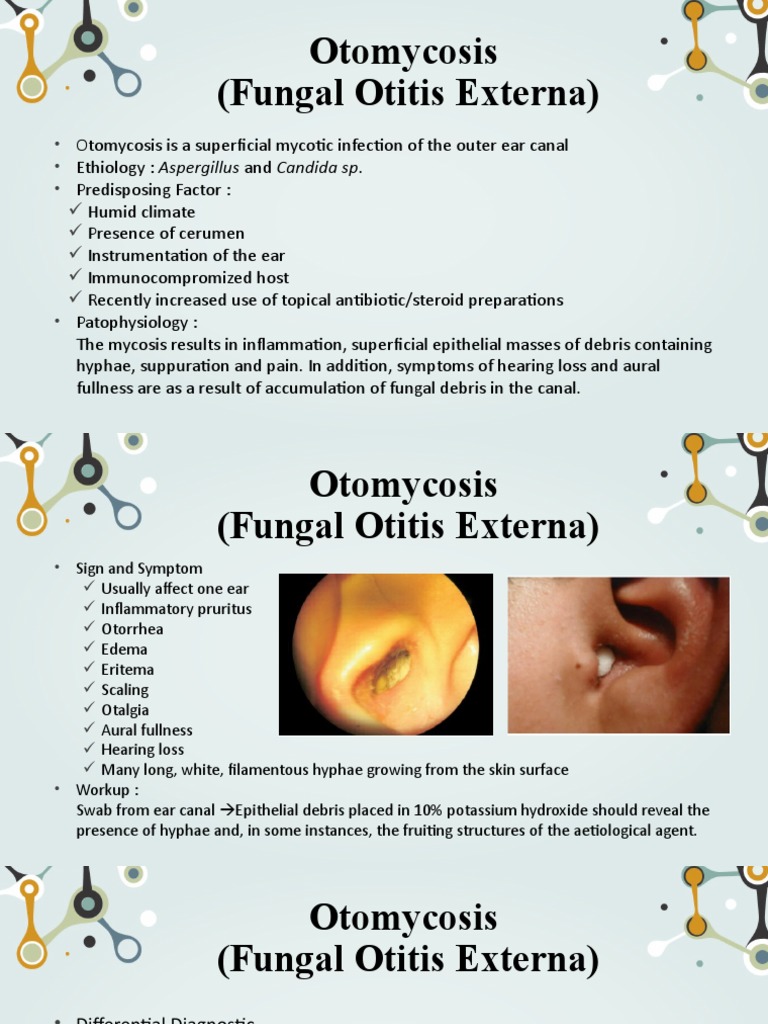 Fungal Otitis Externa