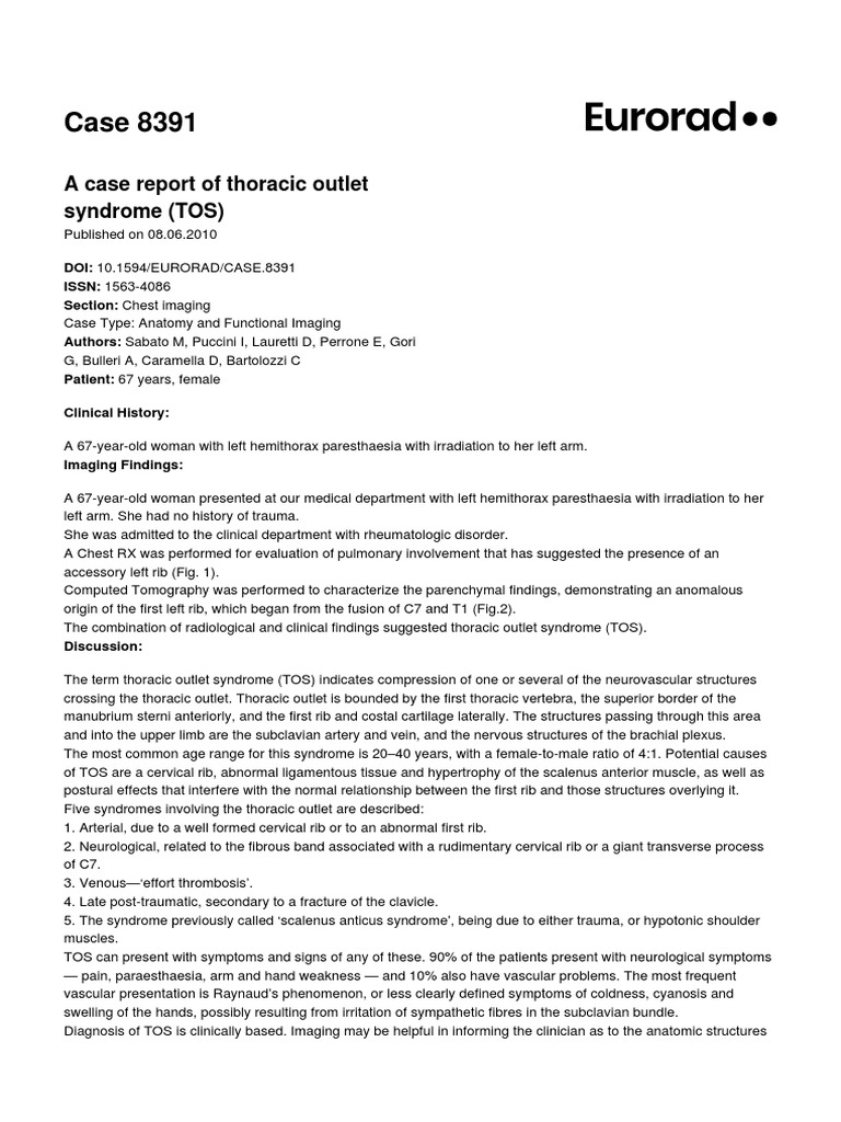 Case 8391: A Case Report of Thoracic Outlet Syndrome (TOS) | PDF ...