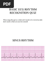 ECG - EKG Practice Quiz (Identify Rhythms) | PDF | Electrocardiography ...
