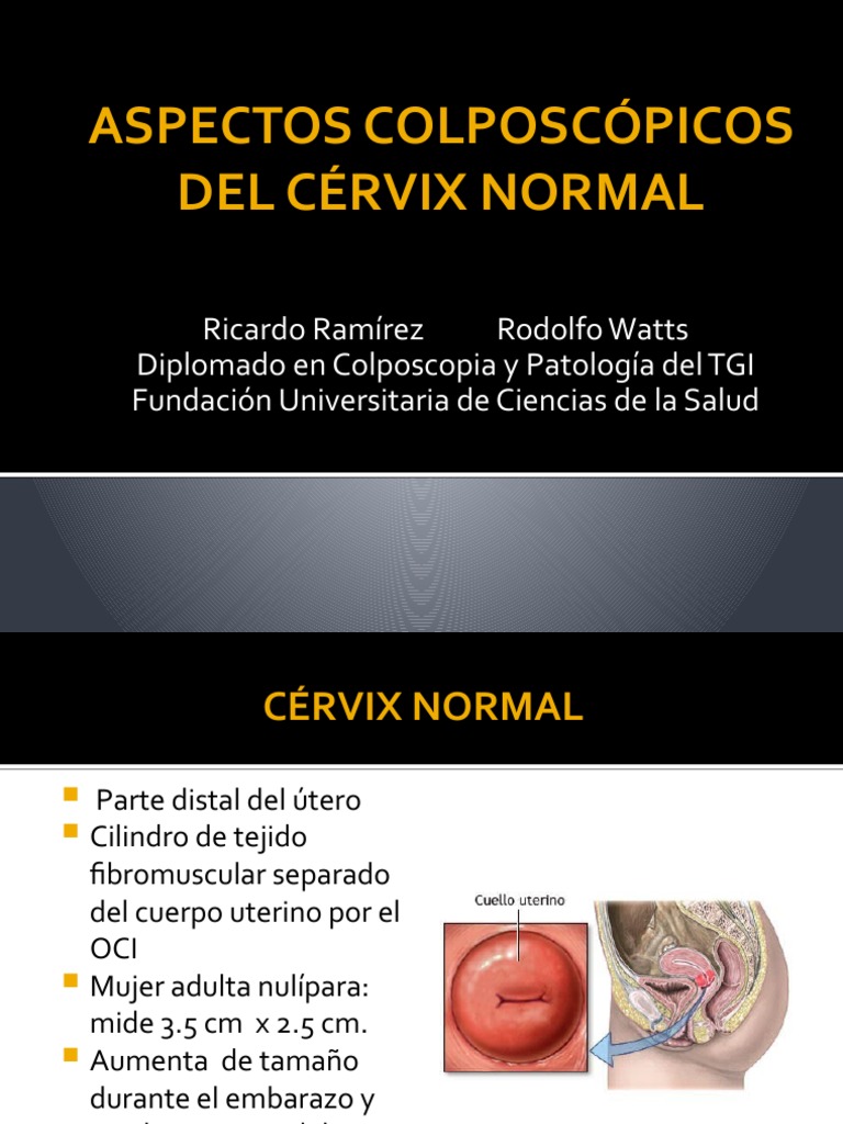 Aspectos Colposcopicos Del Cervix Normal + Ectopia | PDF | Vagina ...