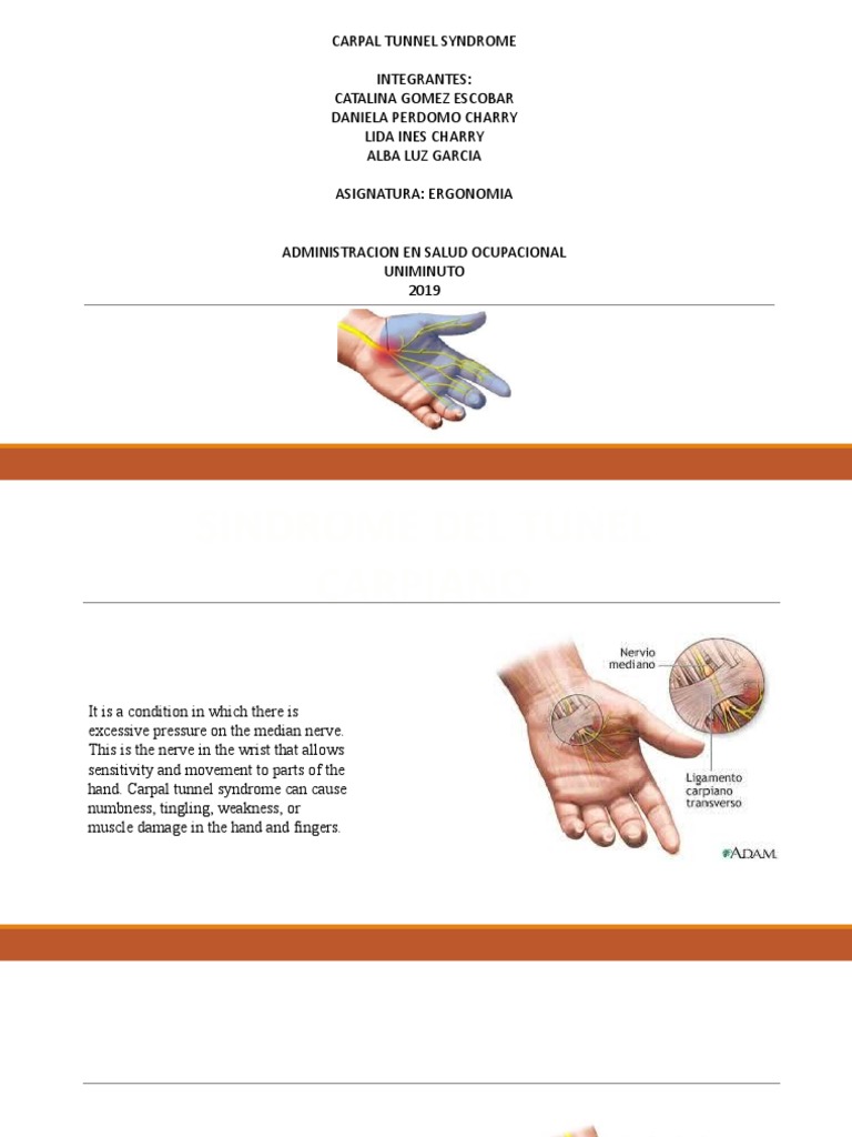 Carpal Tunnel Syndrome Integrantes: Catalina Gomez Escobar Daniela ...