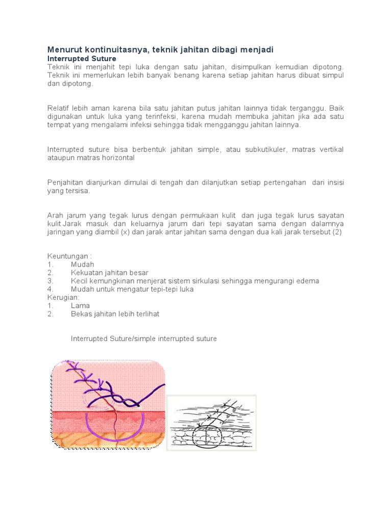 Teknik Jahitan Operasi dan Variasinya | PDF