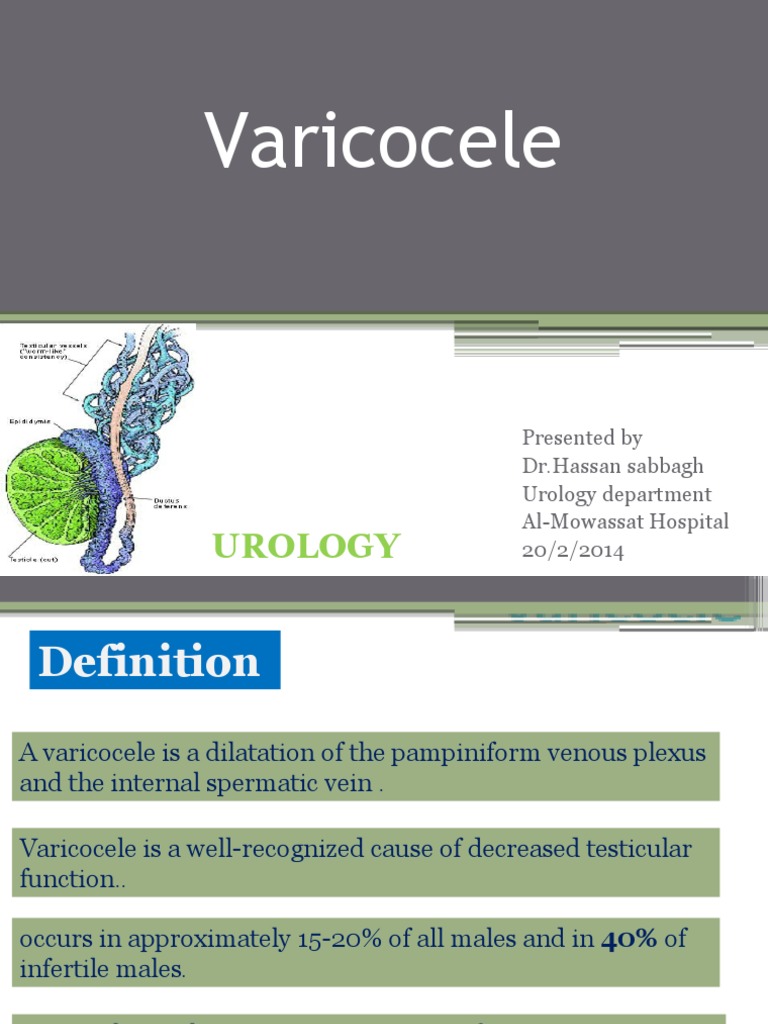 VARICOCELE | PDF | Testicle | Vein