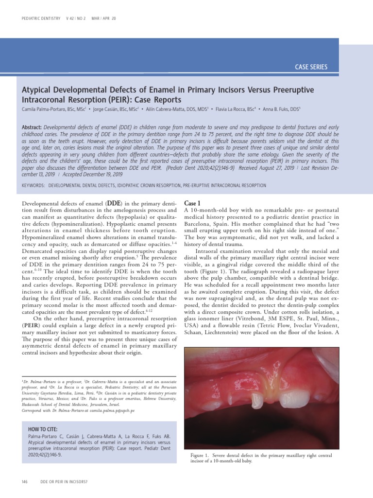 Atypical Developmental Defects of Enamel in Primary Incisors Versus ...