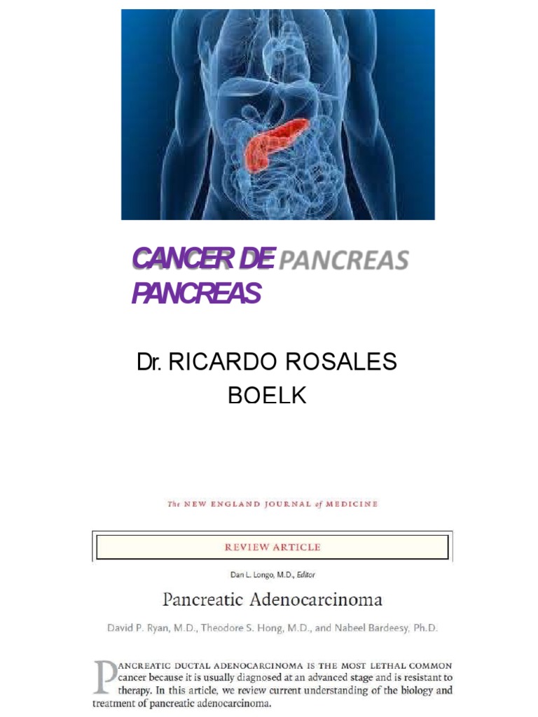 Cancer Pancreas | PDF | Cáncer de páncreas | Cáncer