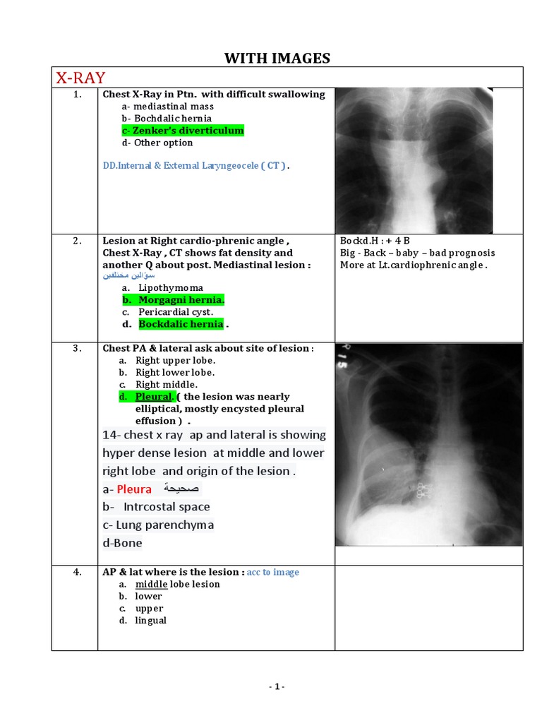 Chest PDF | PDF | Lung | Pneumonia