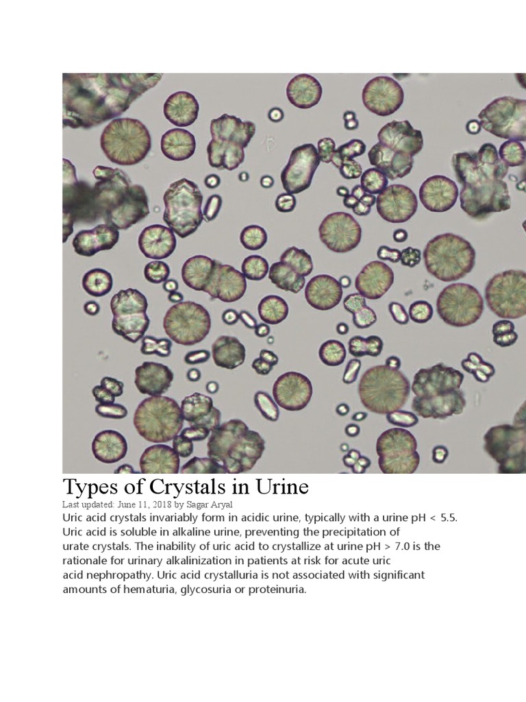 Calcium Carbonate Crystals In Urine