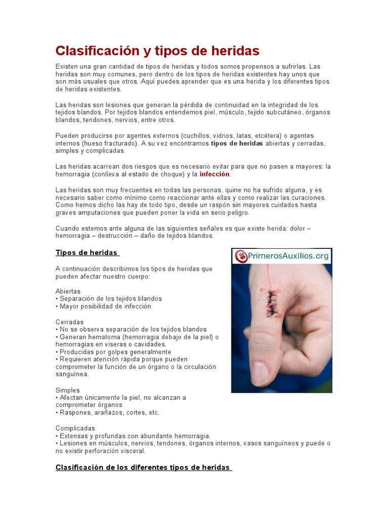 Clasificación y Tipos de Heridas | PDF | Herida | Piel