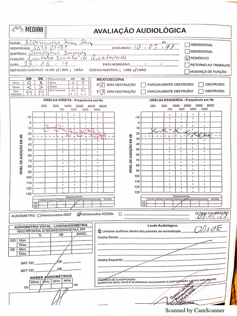 Audiometria PDF | PDF