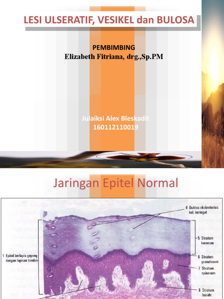 Lesi Ulseratif, Vesikel, Dan Bulosa | PDF