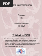 Reading EKGs For Beginners | PDF | Atheroma | Electrocardiography