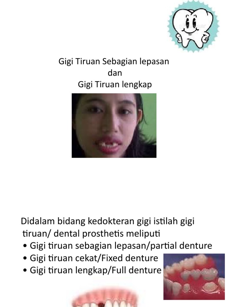 GTSL Dan GTL | PDF