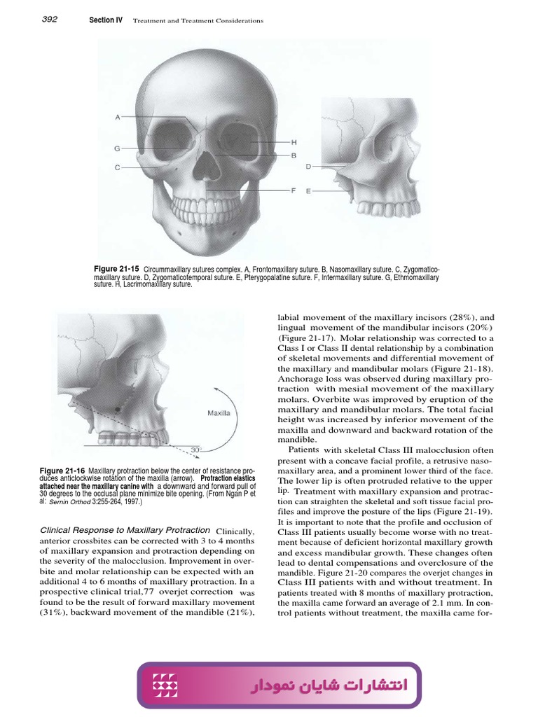Textbook of Orthodontics Samir Bishara 599 52MB 401 407 | PDF | Human ...