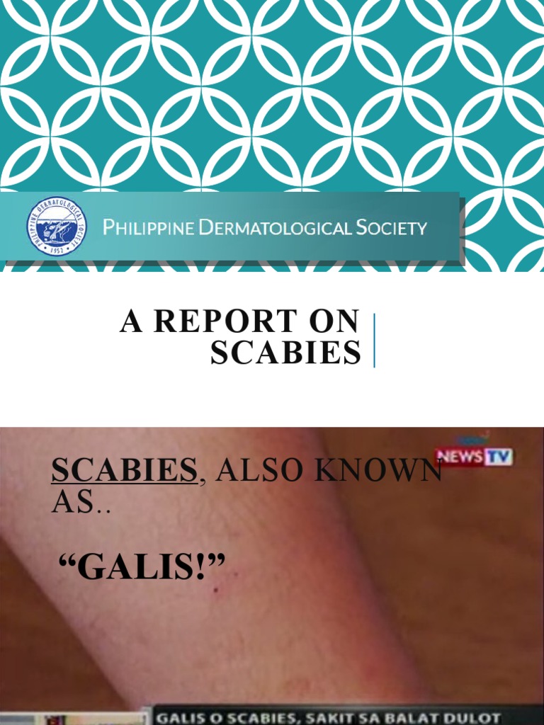A Report On Scabies | PDF | Microbiology | Health Sciences
